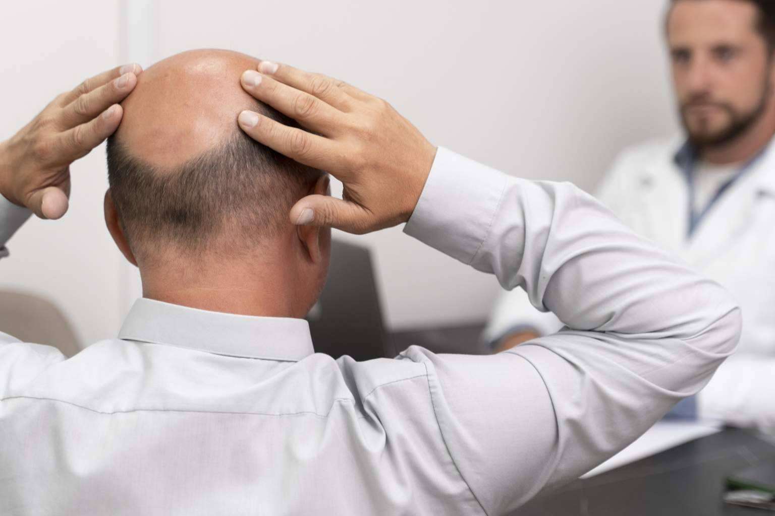 Las causas de la calvicie en España - Somos Economia